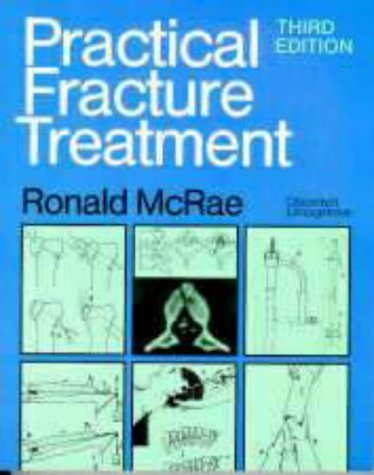 Practical Fracture Treatment: 9780443048098: Medicine & Health Science ...