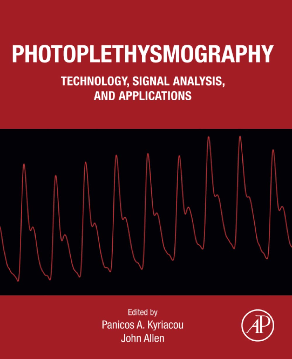 Photoplethysmography: Technology, Signal Analysis and Applications ...