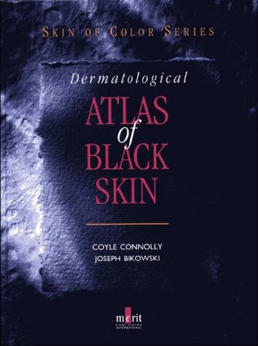 Dermatological Atlas of Black Skin (Skin of Color): Connelly, Coyle ...