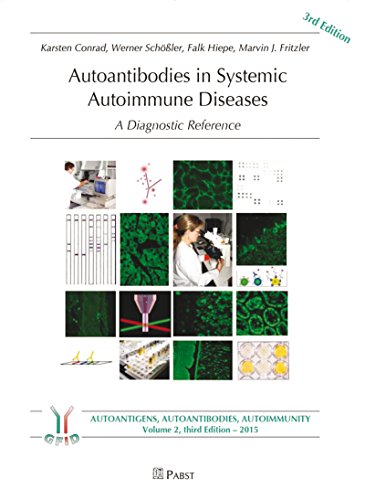 Autoantibodies in Systemic Autoimmune Diseases: A Diagnostic Reference ...