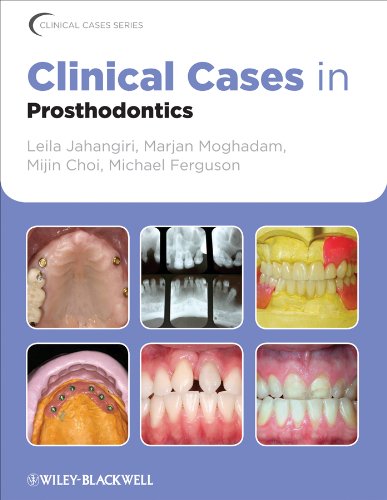 Clinical Cases in Prosthodontics (Clinical Cases (Dentistry) Book 9 ...