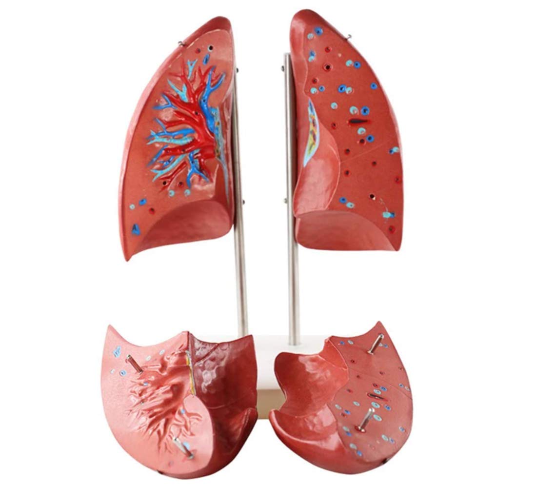 Buy tjz Human Lung Anatomical Model, Lung Breathing Lung Segment Model ...
