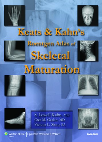 Keats and Kahn's Roentgen Atlas of Normal Skeletal Maturation ...