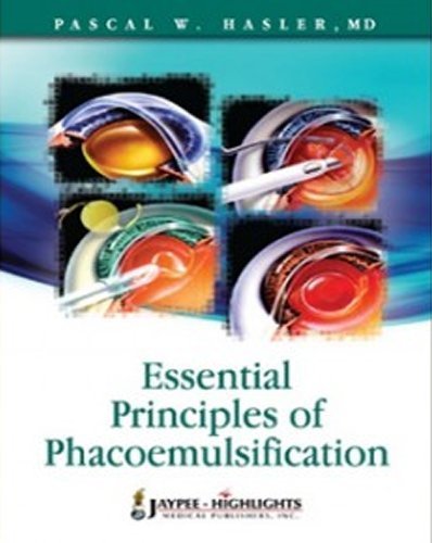 Essential Principles of Phacoemulsification by Pascal W Hasler ...