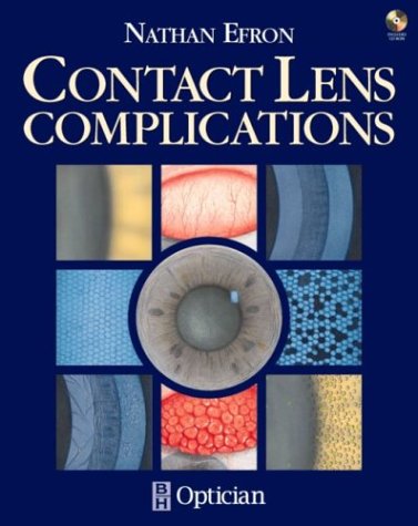 Contact Lens Complications with CD-ROM: Expert Consult - Online and ...
