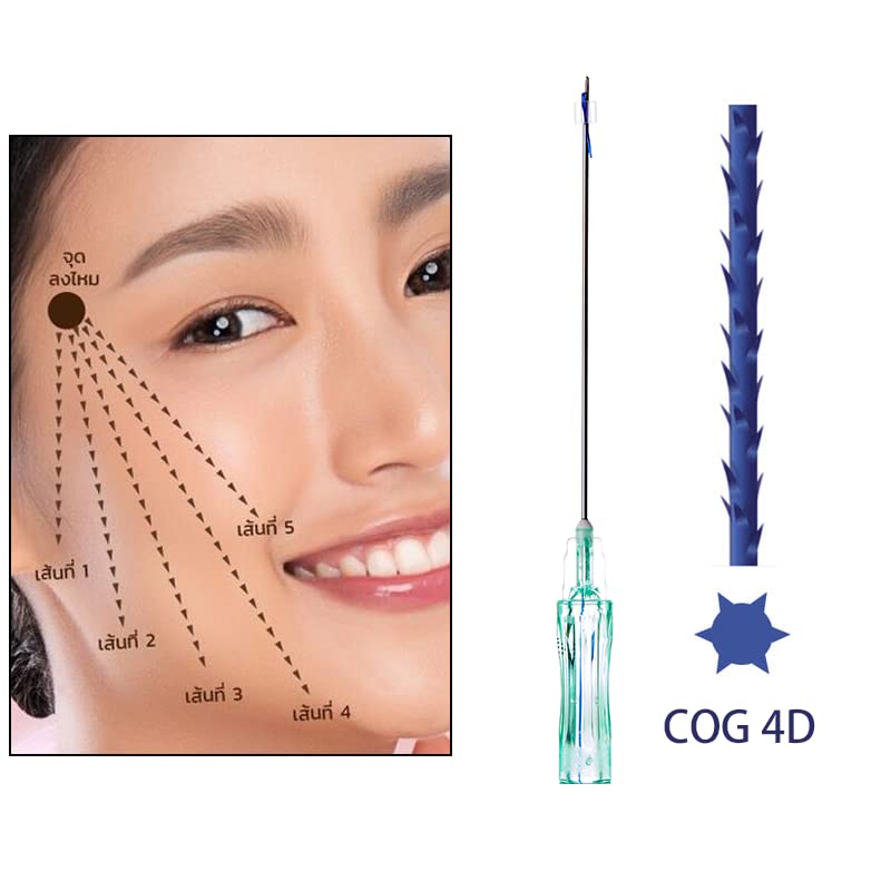 Pdo Cog Pdo Thread Cog para cara y cuerpo entero engranaje 4D W 21G 90M ...