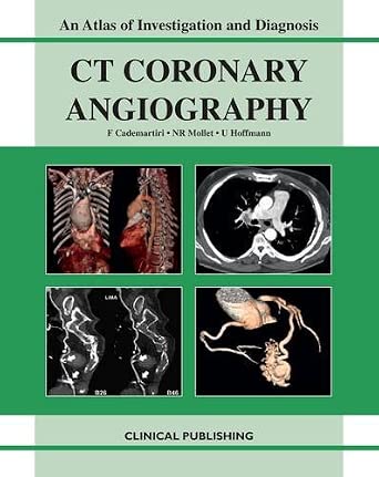 CT Coronary Angiography: An Atlas of Investigation and Diagnosis ...