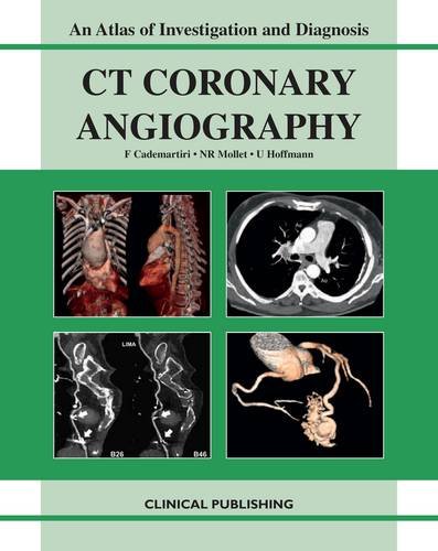 CT Coronary Angiography: Atlas of Investigation and Management ...
