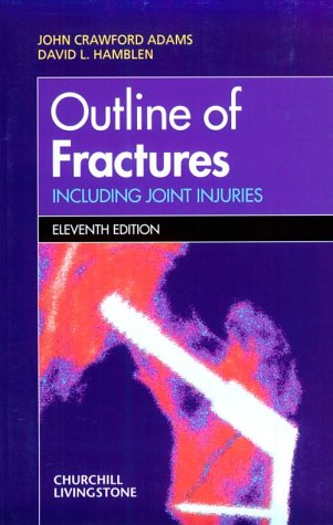Outline of Fractures: Including Joint Injuries: 9780443060274: Medicine ...