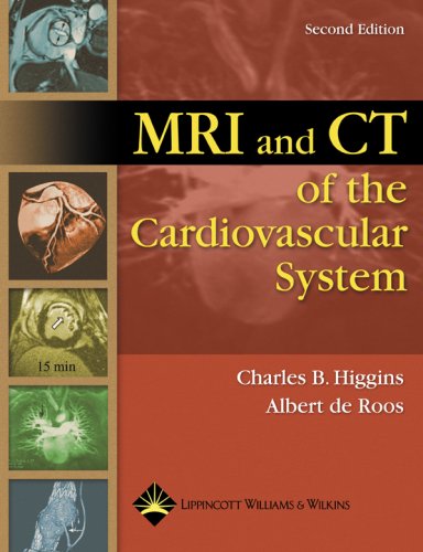 MRI and CT of the Cardiovascular System: 9780781762717: Medicine ...