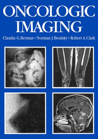 Oncologic Imaging: A Clinical Perspective: 9780070051140: Medicine ...