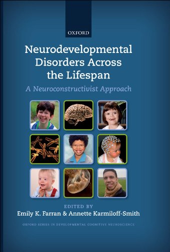 Amazon | Neurodevelopmental Disorders Across the Lifespan: A ...