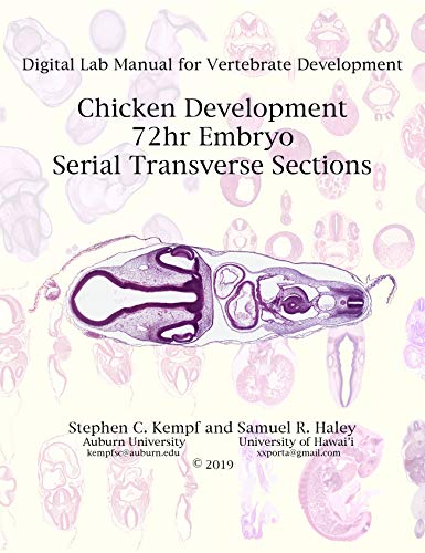 72hr Chicken Embryo Serial Transverse Sections: Digital Lab Manual for ...