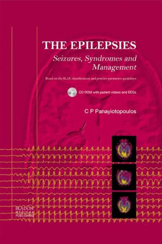 The Epilepsies: Seizures, Syndromes and Management: 9781904218340 ...
