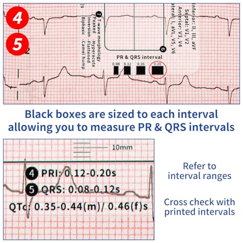 Regla de ECG, regla de ECG de 2 piezas con la interpretación de ECG/ECG ...
