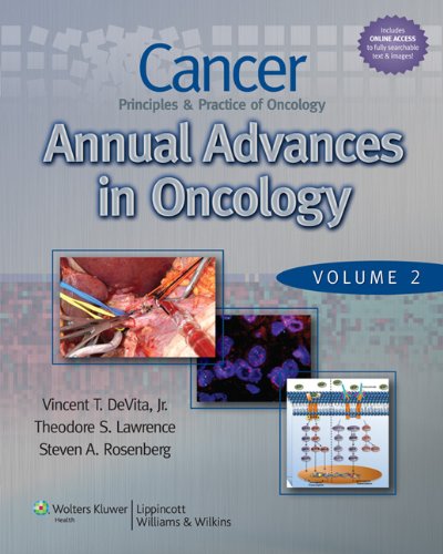 Buy Cancer: Principles & Practice of Oncology: Volume 2 (Cancer ...