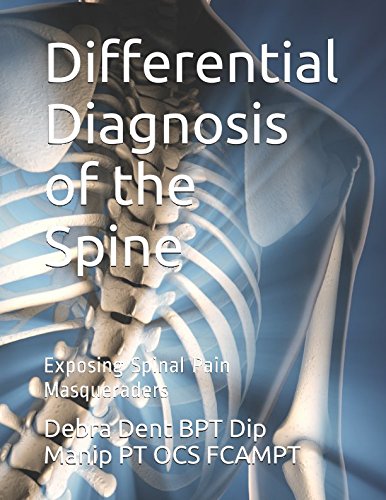 Differential Diagnosis of the Spine: Exposing Spinal Pain Masqueraders ...
