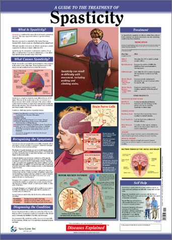 Diseases Explained: Spasticity Wall Chart : Lexi-Comp: Amazon.in: Books