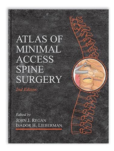 Amazon | Atlas of Minimal Access Spine Surgery | Regan, John, Isador ...