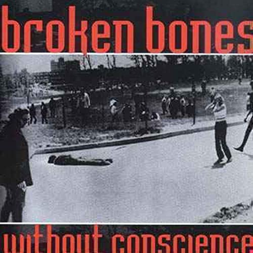 Amazon Music Unlimited - Broken Bones 『Without Conscience』