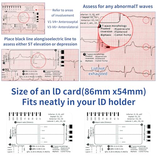 Regla de ECG, regla de ECG de 2 piezas con la interpretación de ECG/ECG ...