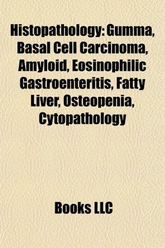 Histopathology: Gumma, Basal-cell carcinoma, Amyloid, Neurofibrillary ...