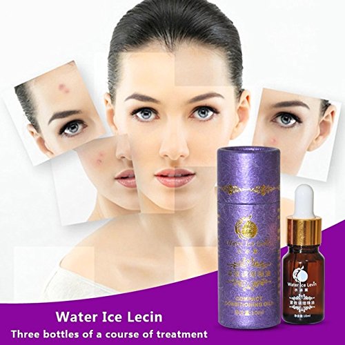 Water Ice Levin at Peter Chavez blog