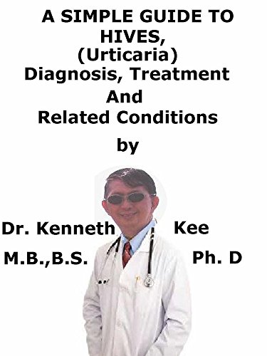 A Simple Guide To Hives, (Urticaria) Diagnosis, Treatment And Related ...
