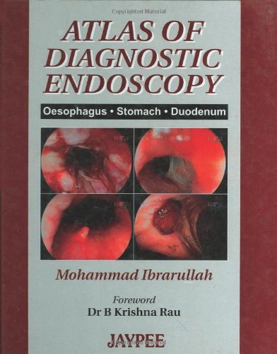 Buy ATLAS OF DIAGNOSTIC ENDOSCOPY Book Online at Low Prices in India ...
