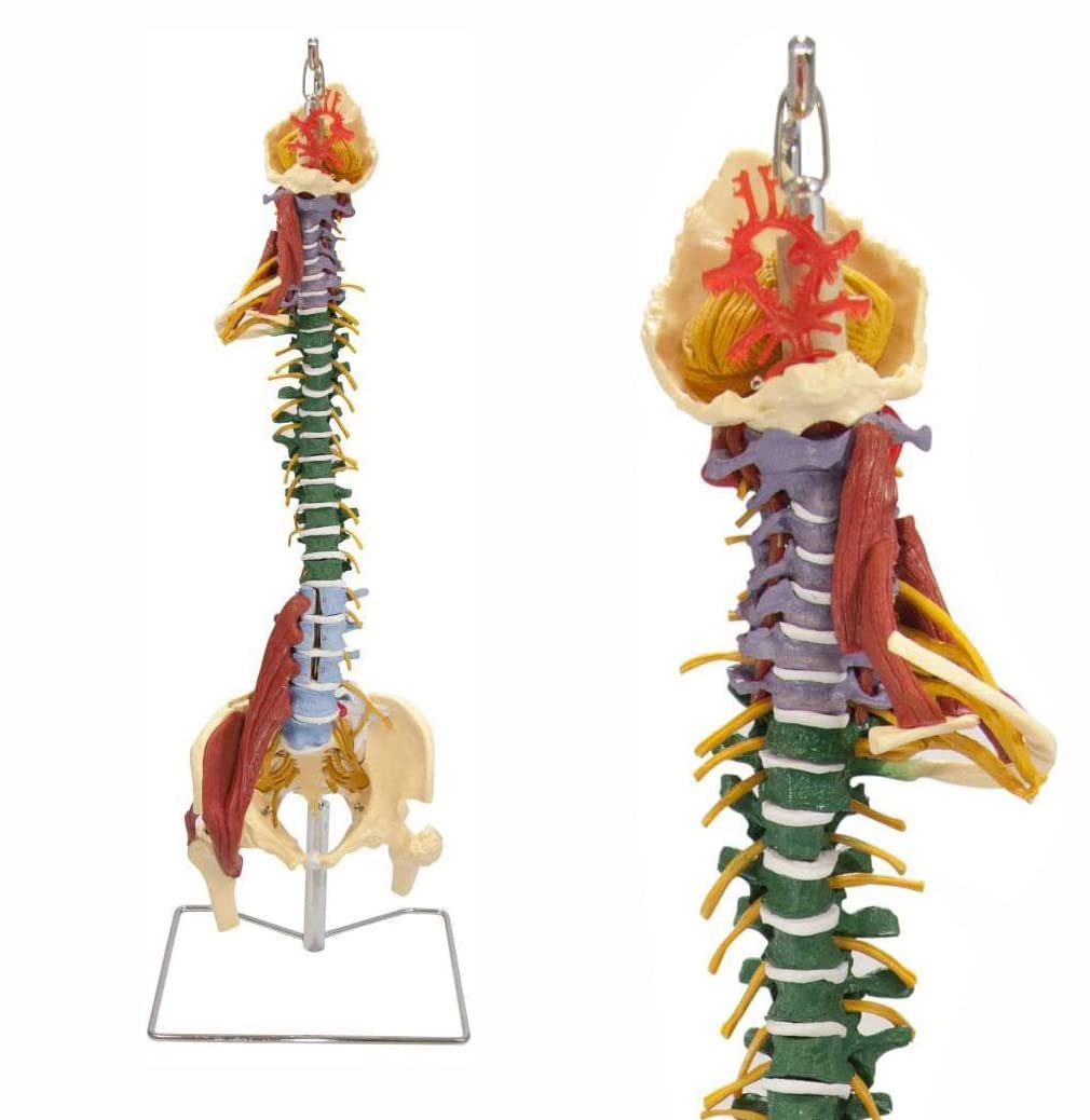 Uigjiog Human Spine Model 85cm Anatomy Muscle Spine With Disorders ...