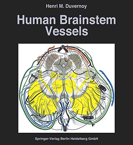 Human Brainstem Vessels: Henri M. Duvernoy: 9783540083368: Amazon.com ...