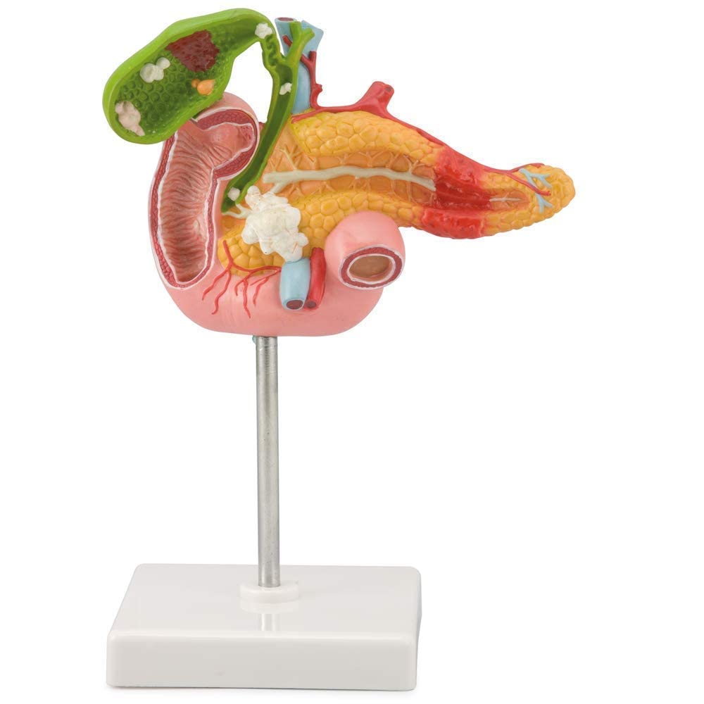 Anatomy Model Anatomy Models Pancreas Gallbladder Model Pancreas Spleen ...