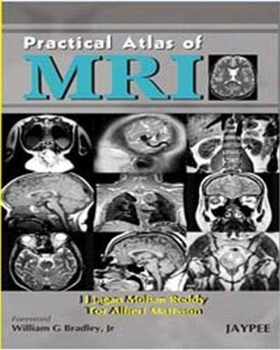 Buy Practical Atlas of MRI Book Online at Low Prices in India ...