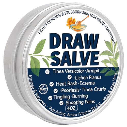 Best Heat Rash Treatments Include Natural Remedies And Medical ...