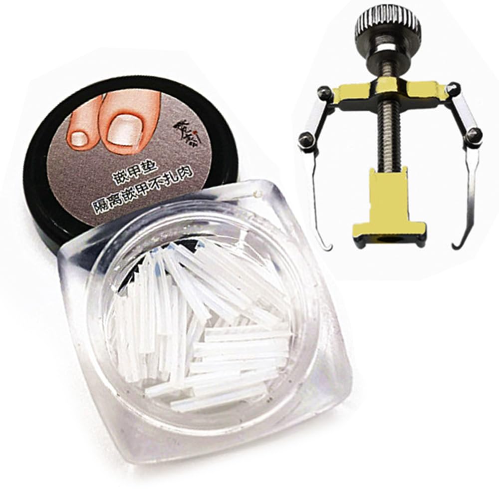 2 Piece Set Ingrown Toenail Correction Strips Brace Kit Ingrown Toenail ...