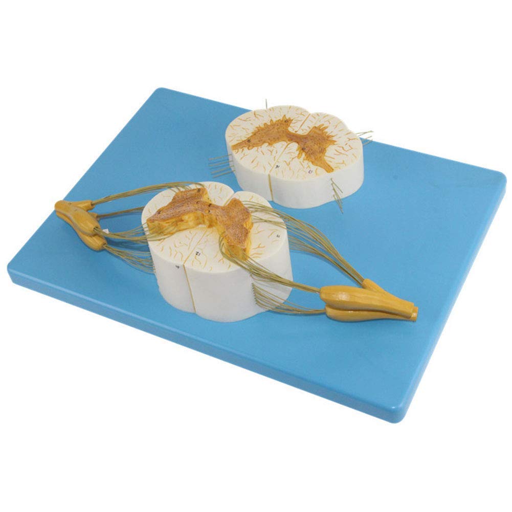 Wqf Spinal Cord Cross Section Model Consists Of A Spinal | Desertcart ...