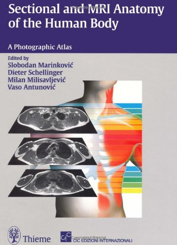 Sectional and MRI Anatomy of the Human Body: Marinkovic, Slobodan ...