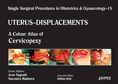 Single Surgical Procedures in Obstetrics and Gynaecology 15: A Colour ...