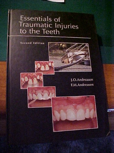 Essentials of Traumatic Injuries to the Teeth: A Step-by-Step Treatment ...