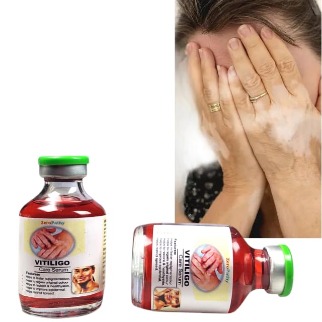 Buy vitiligo corrector cream Correcting Gel 35ml | Safed Dag Correction ...