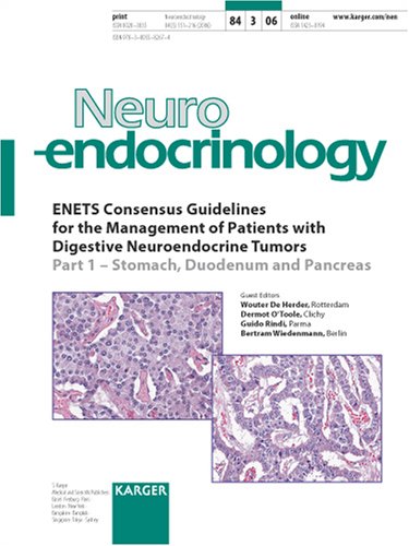 Buy Enets Consensus Guidelines for the Management of Patients With ...