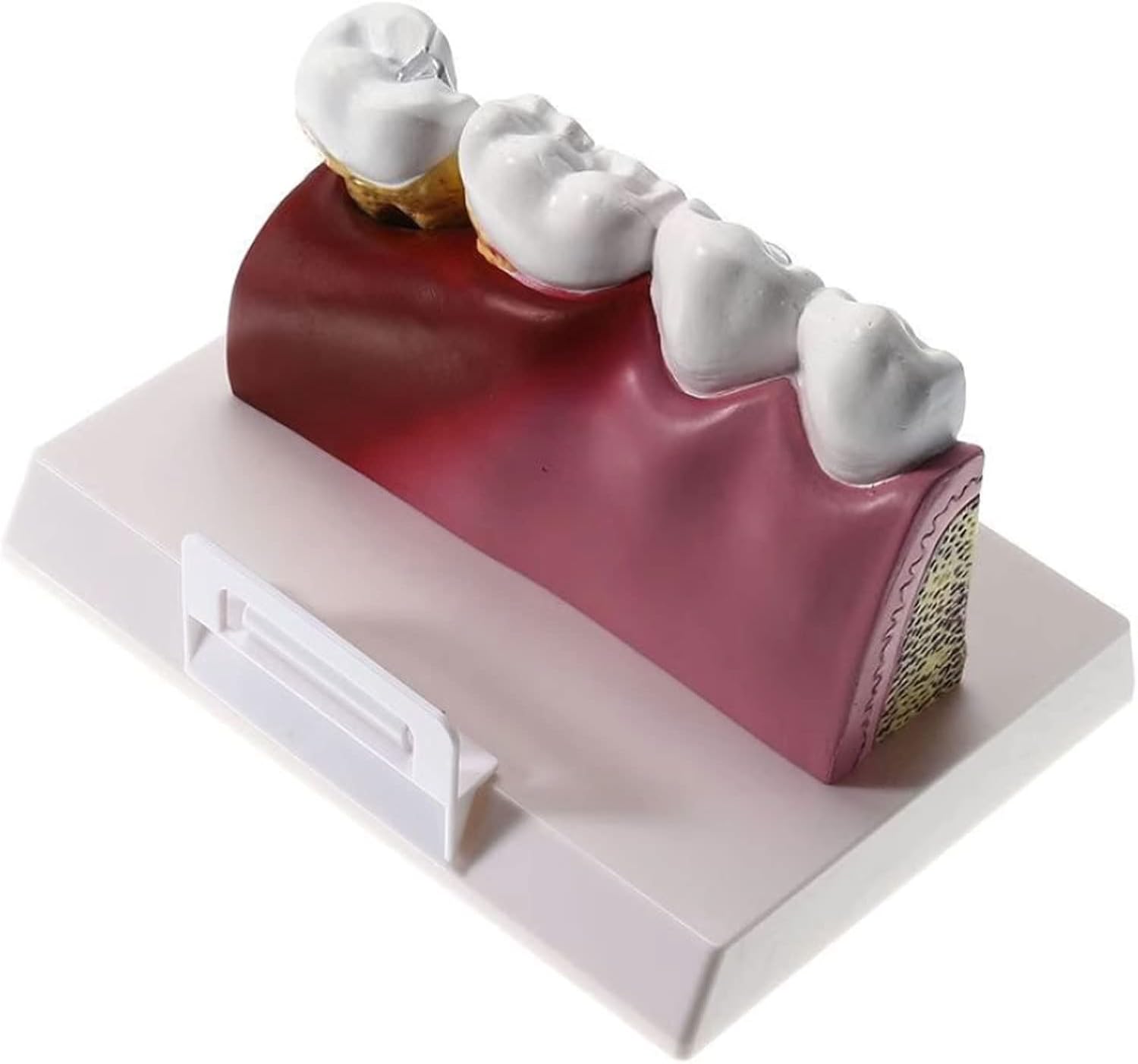 Anatomical Models Teeth Cross-Section Model Gums Model Anatomy Teeth ...