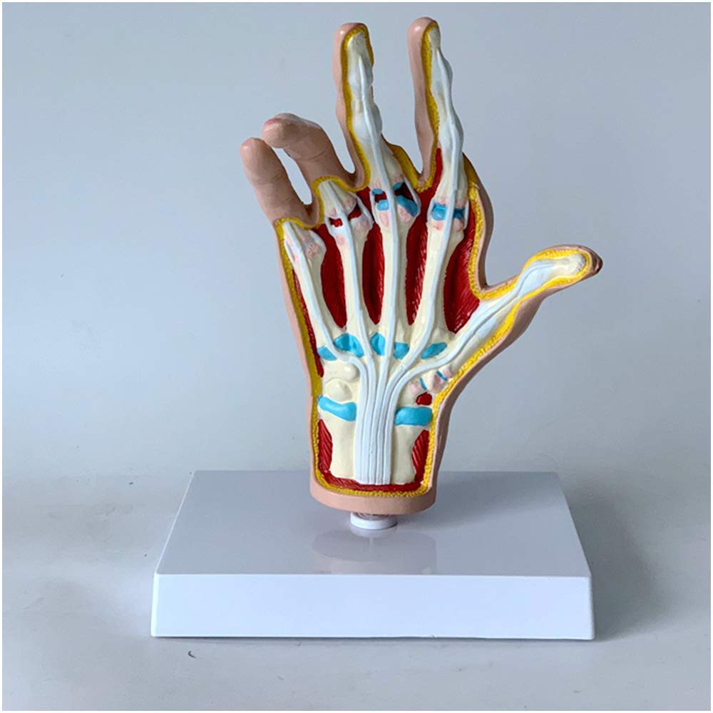 Xhllx Hand Anatomy Model Palm Anatomy Models Human Diseased Palm ...