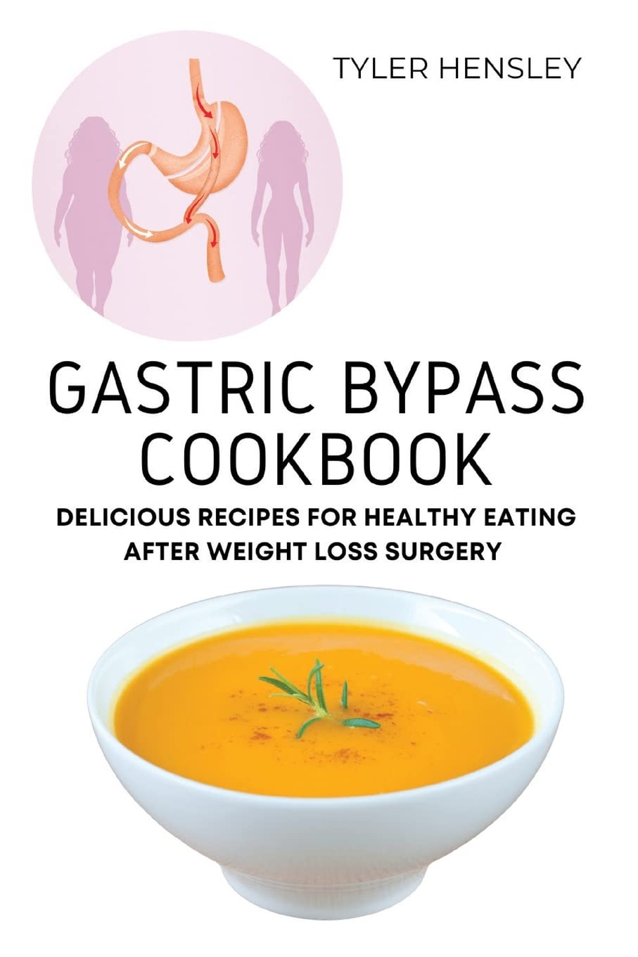 Gastric Bypass Cookbook: Delicious Recipes for Healthy Eating After ...