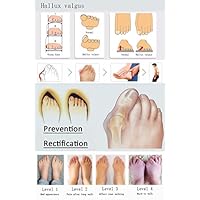JERN Red Gel Silicone toe separator and Bunion Guard : Amazon.in ...