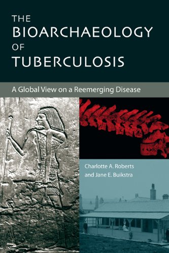 The Bioarchaeology of Tuberculosis: A Global View on a Reemerging ...