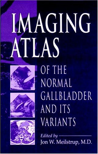 Imaging Atlas of the Normal Gallbladder and Its Variants: 9780849347887 ...