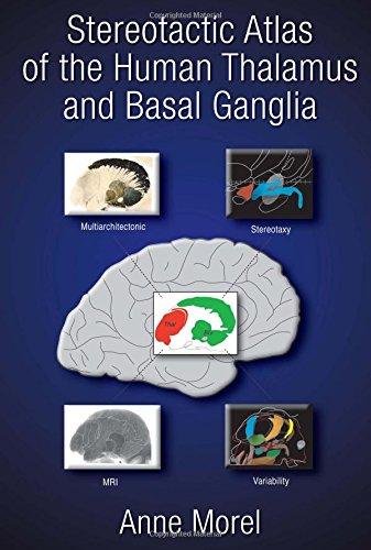 Stereotactic Atlas of the Human Thalamus and Basal Ganglia ...