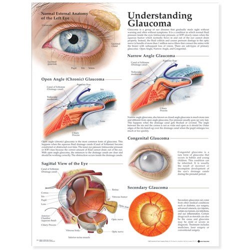Understanding Glaucoma Anatomical Chart by - Amazon.ae