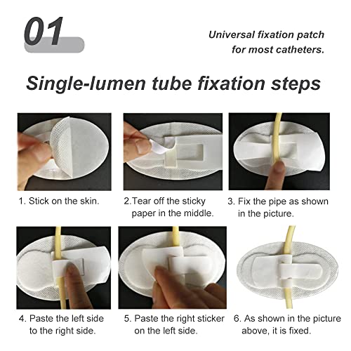Snapklik.com : 4 Pack Catheter Stabilization Device Tape, Catheter Tube ...